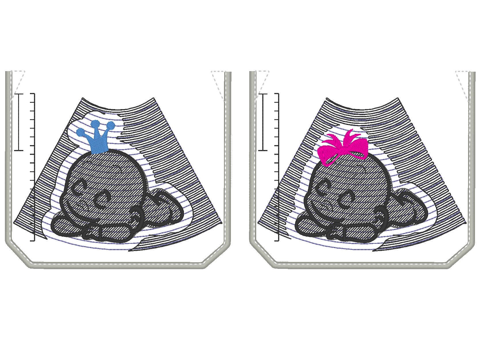 Ultrasound Tech doctor pockets embroidery dsigns Girl and Boy - machine ...